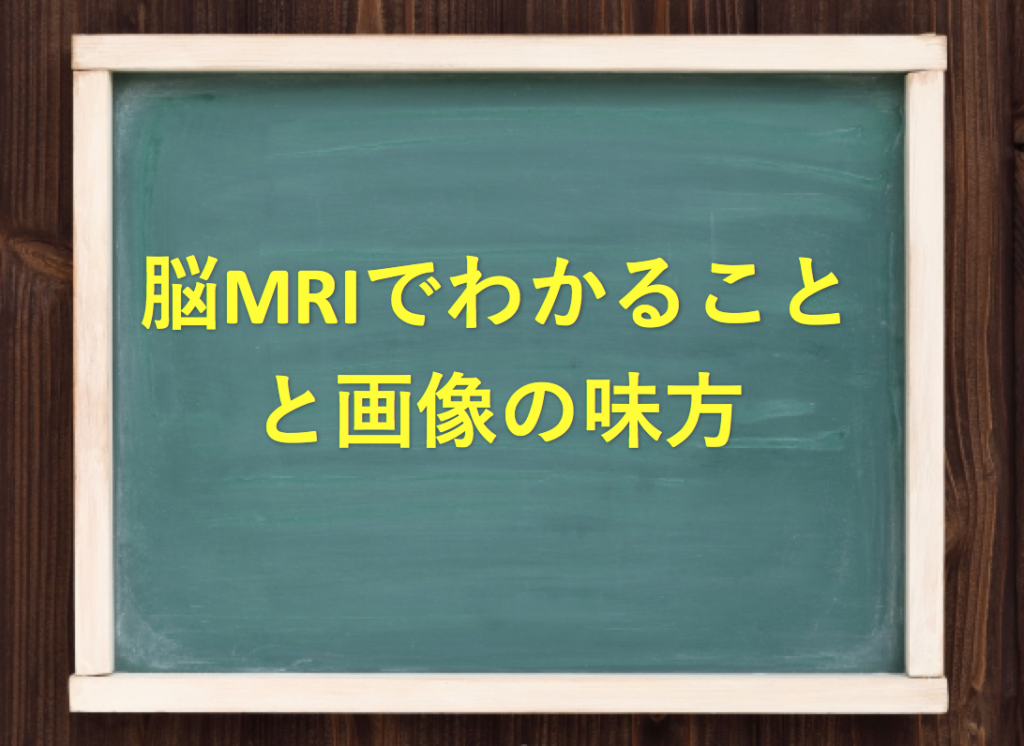 脳MRIでわかることと画像の見方！白い影や白い点は何を示しているの？ | 診療放射線技師.com